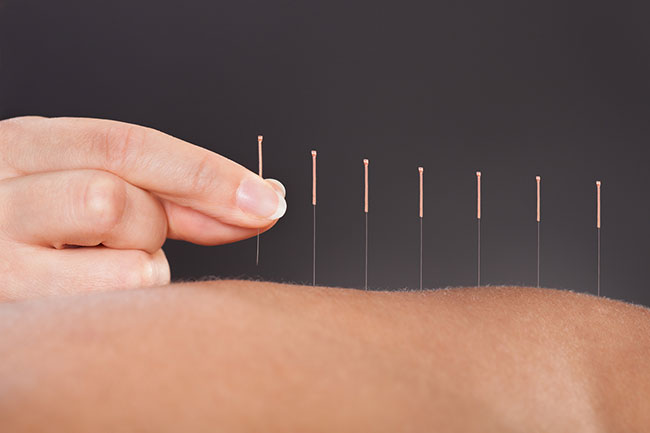 Acupuncture Cost, Asheville, NC - Triveda Wellness